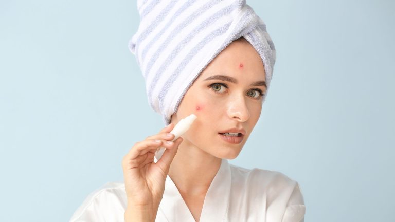 Dermatologist Recommended Acne Treatment Insights